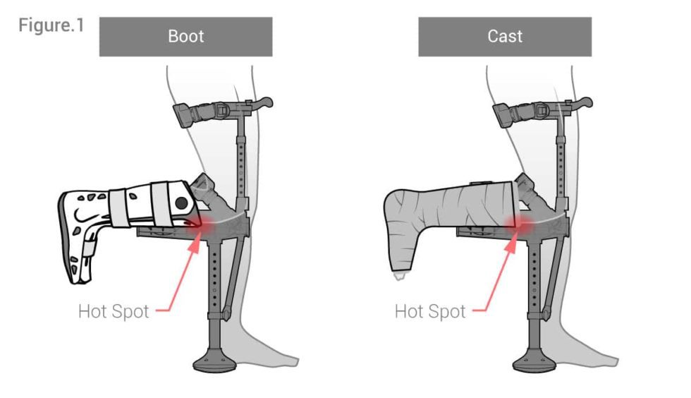 Use with cast or boot - iWALK